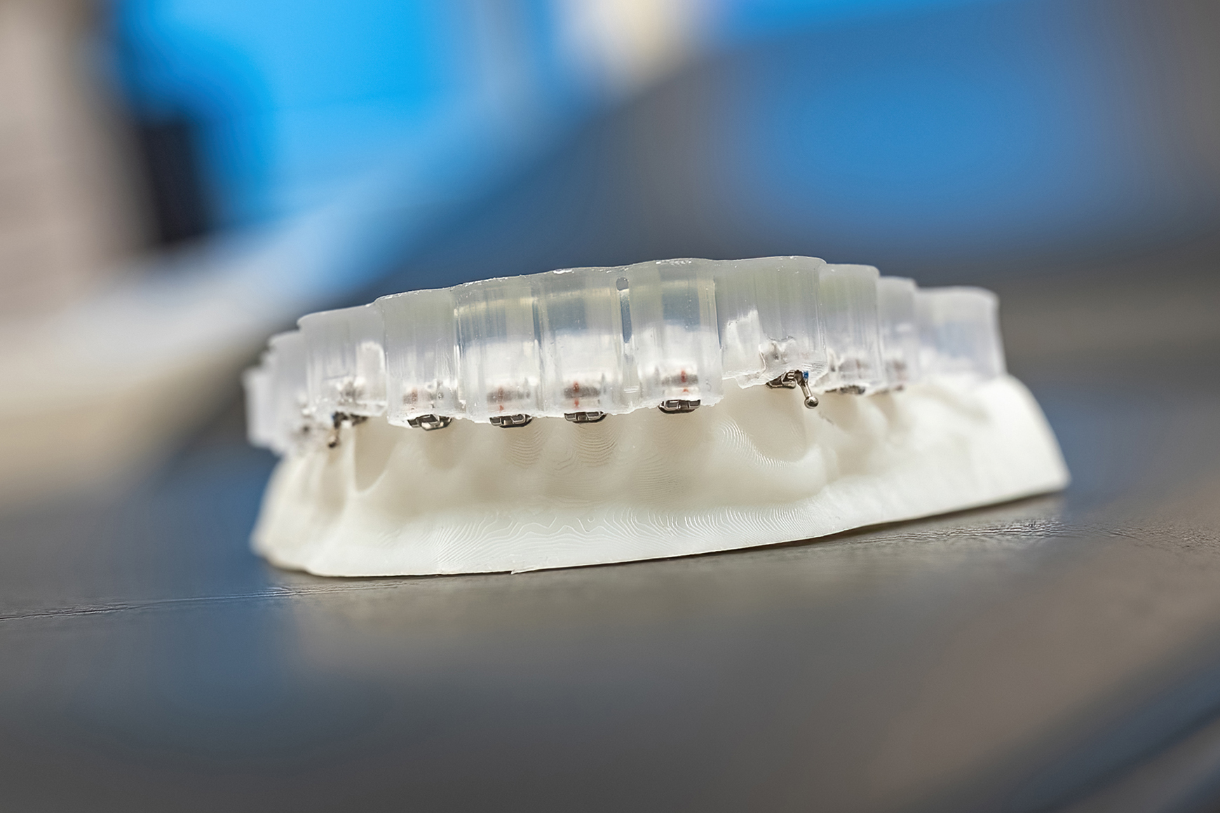 Digitale Kieferorthopädie | Dr. Raphael Hoehr - Kieferorthopäde Borken ...